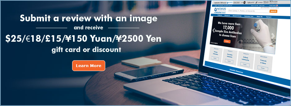 Antibodies, Kits, Proteins and Research Reagents: Novus Biologicals