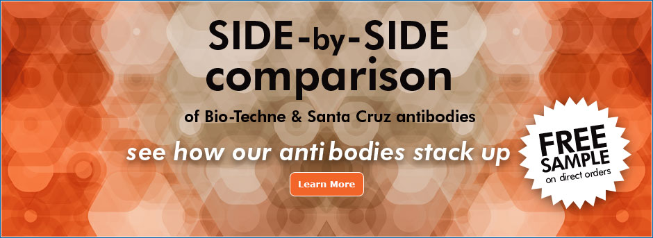 Antibodies, Kits, Proteins and Research Reagents: Novus Biologicals
